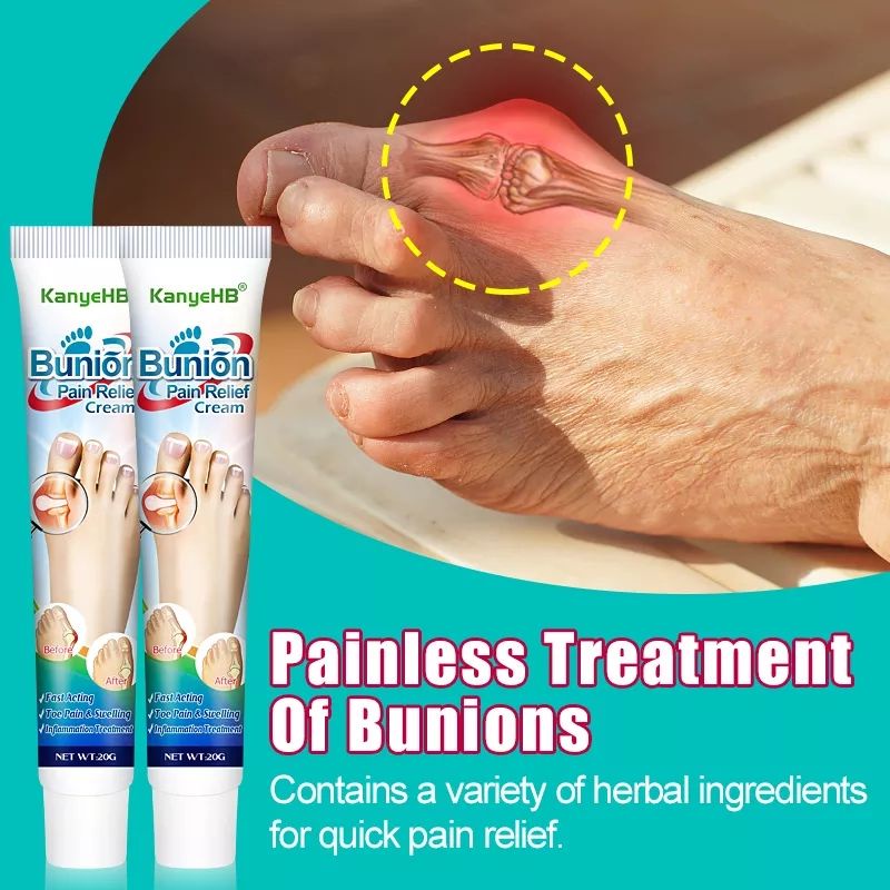 Jual Salep Pereda Nyeri, Krim Korektor Valgus Sendi Kaki, Pengurang ...