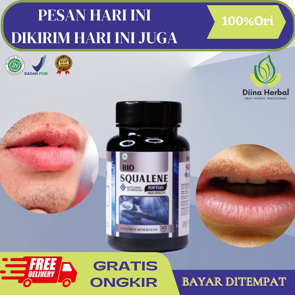 Jual Obat Penghilang Bintik Bintik Putih di Bibir, Oles Bercak Putih Di ...
