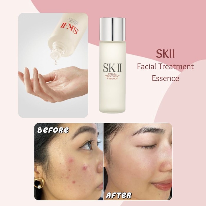Jual SK-II SK2 SKII FTE Facial Treatment Essence 10ml | Shopee Indonesia