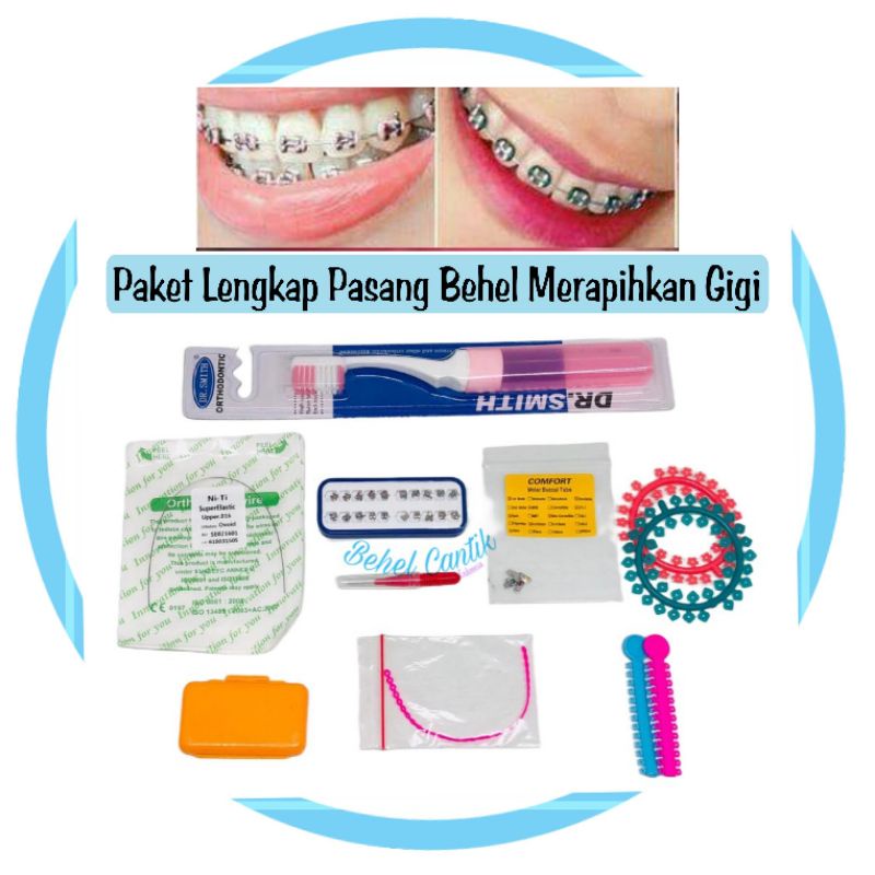Jual Paket Lengkap Pasang Behel Sendiri | Behel Perawatan Merapihkan ...