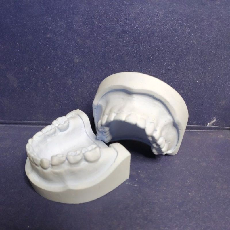Jual Model study gips gipsum gigi dental | Shopee Indonesia