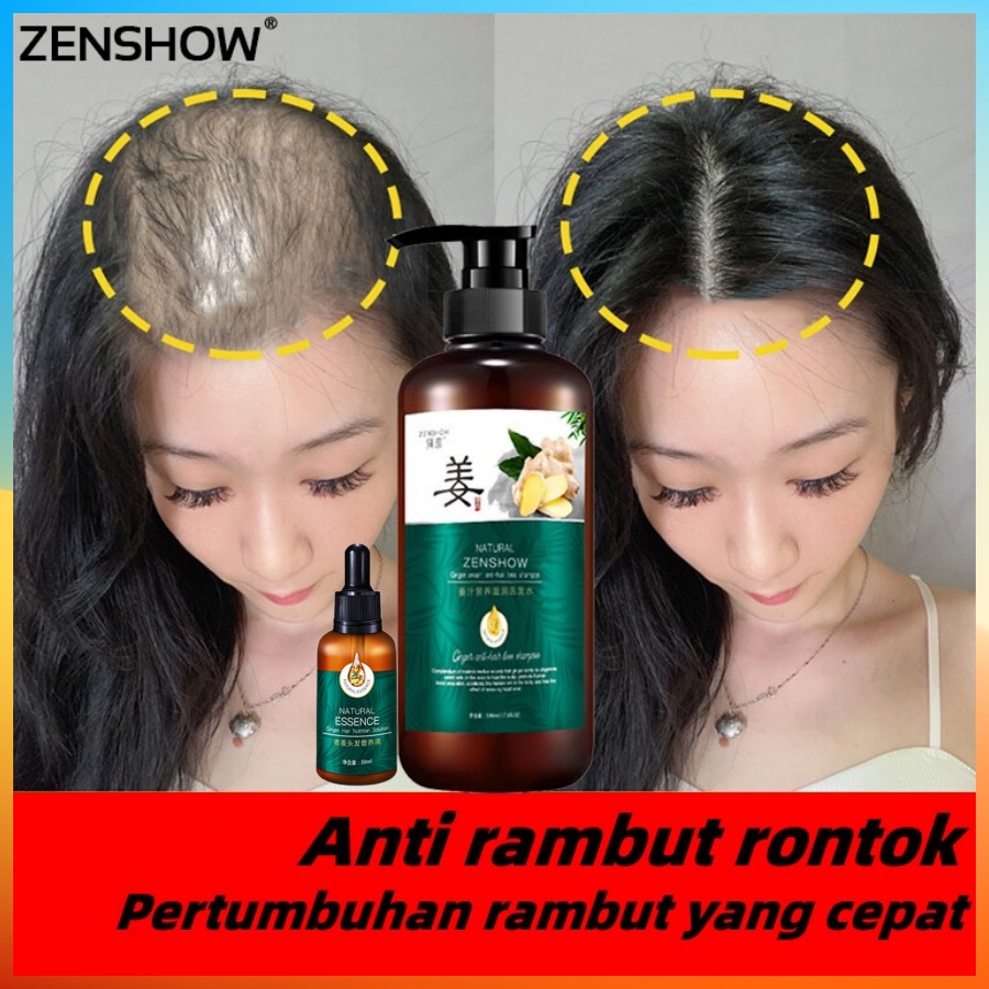 Jual ZHENXIU shampo rambut rontok 500ml Meningkatkan Pertumbuhan Rambut ...