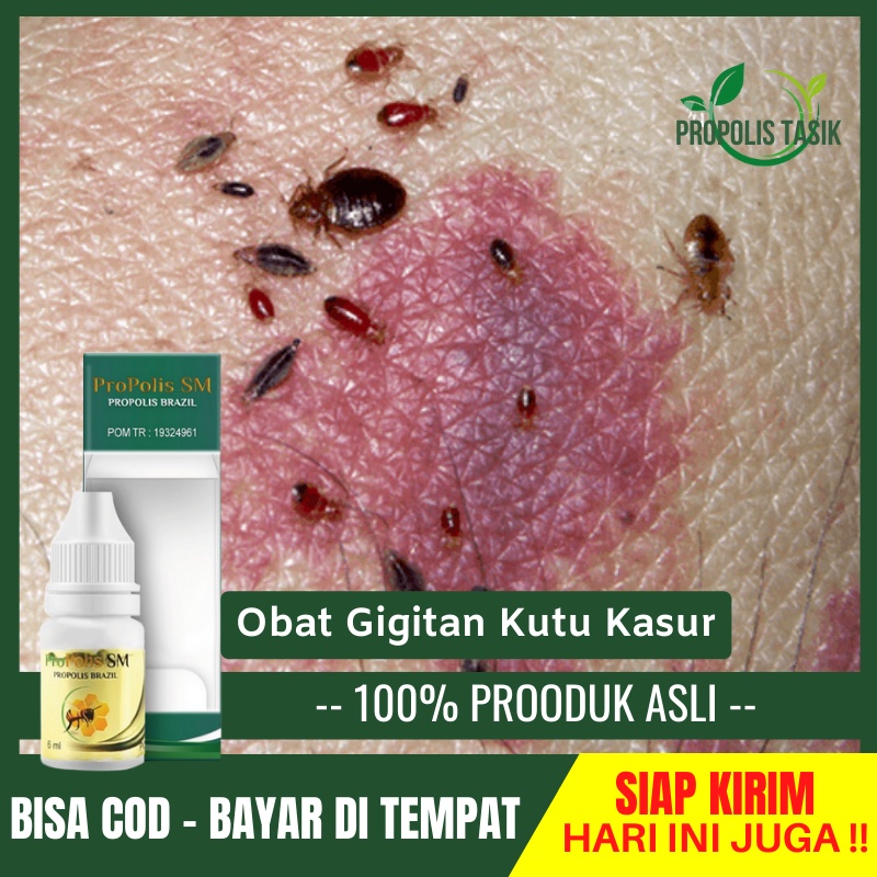 Jual Obat Gigitan Kutu Kasur, Pembasmi Kutu Busuk Kasur, Kutu Busuk ...