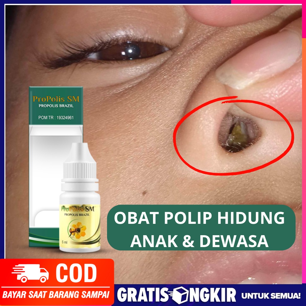 Jual Obat Tetes Polip Hidung, Obat Hidung Berlendir & Ada Benjolan ...
