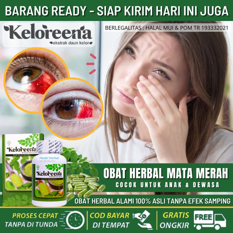 Jual Obat Sklera Mata Berdarah, Bercak Merah di Bola Mata Putih, Obat ...