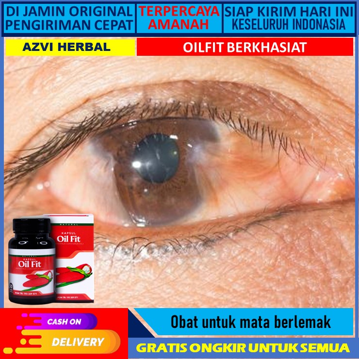 Jual obat mata berlemak Obat mata berlemak Obat mata petrigium Obat ...