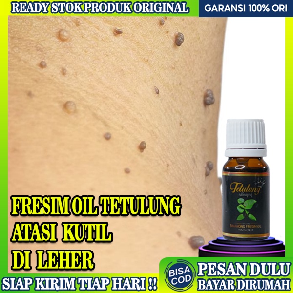 Jual Obat Kutil Paling Ampuh, OBAT KUTIL DI LEHER, OBAT OLES FRESIM OIL ...