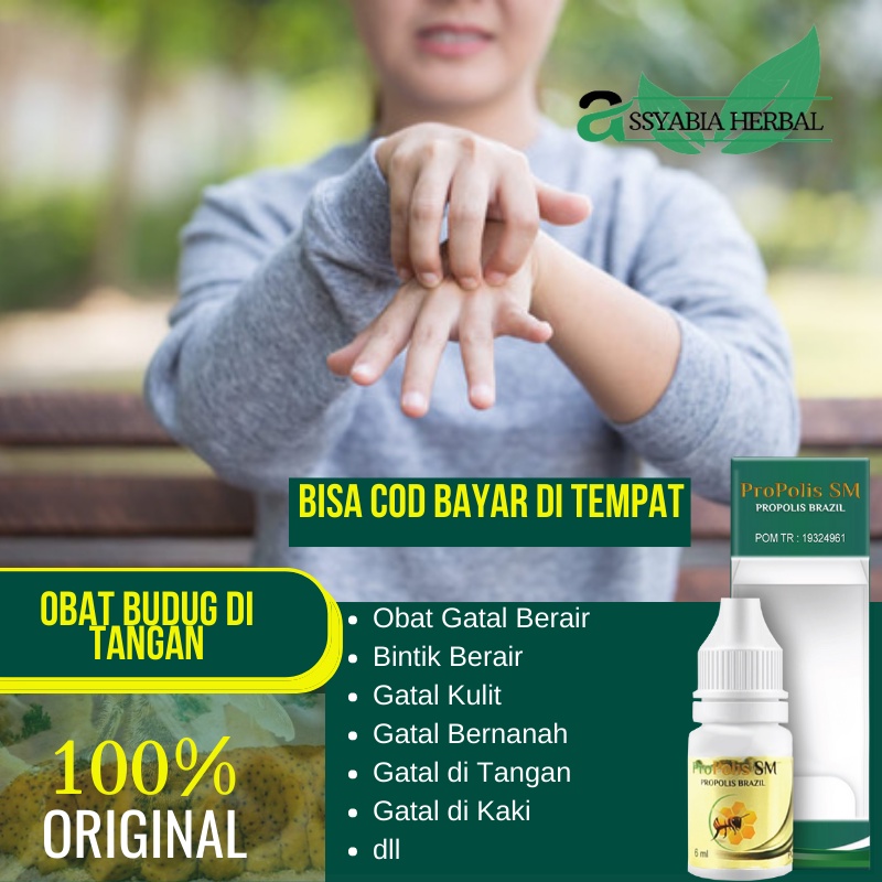 Jual Obat Jari Tangan Gatal Berair Parah - Obat Gatal Jari Tangan ...