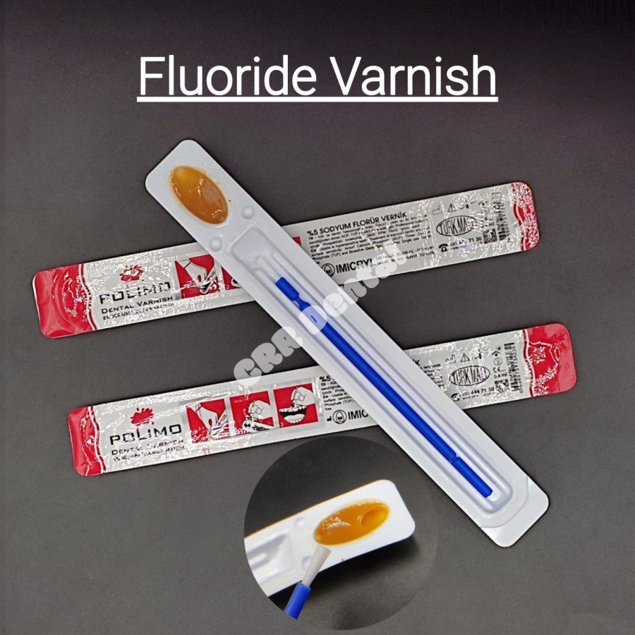 Jual DENTAL IMICRYL POLIMO FLUORIDE VARNISH / serupa 3M CLINPRO WHITE ...