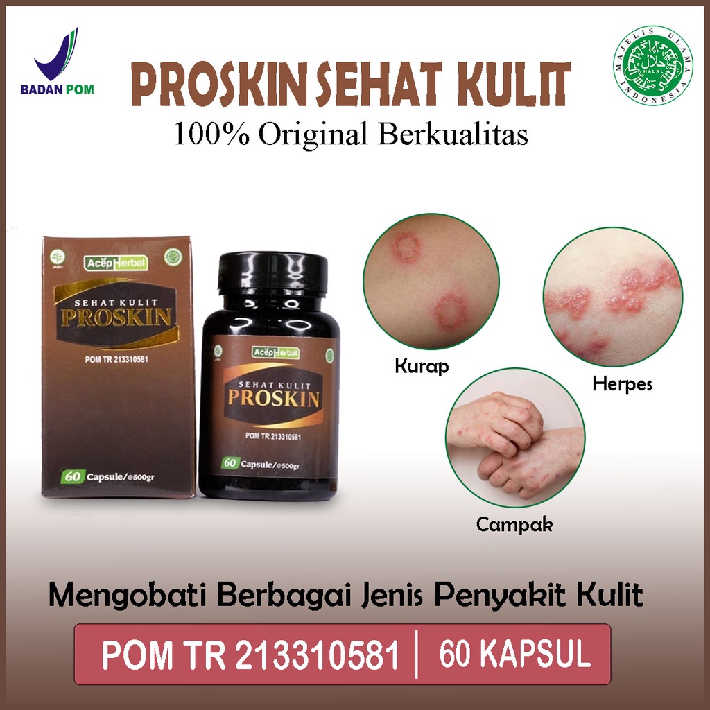 Jual Proskin Sehat Kulit Untuk Penyakit Kurap Jerawat Herpes Campak ...