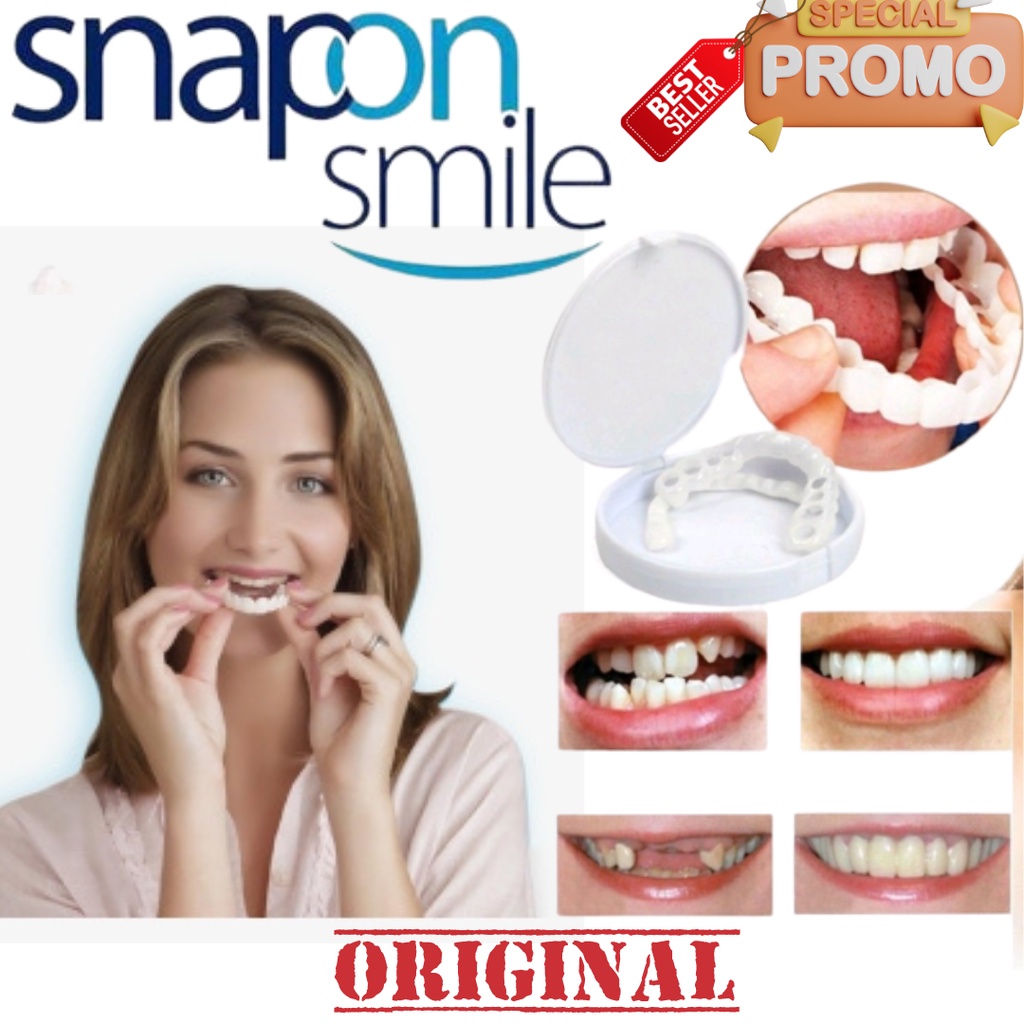 Jual Snap On Smile Official Snap On Smile Original 100% Asli 1 Set Atas ...