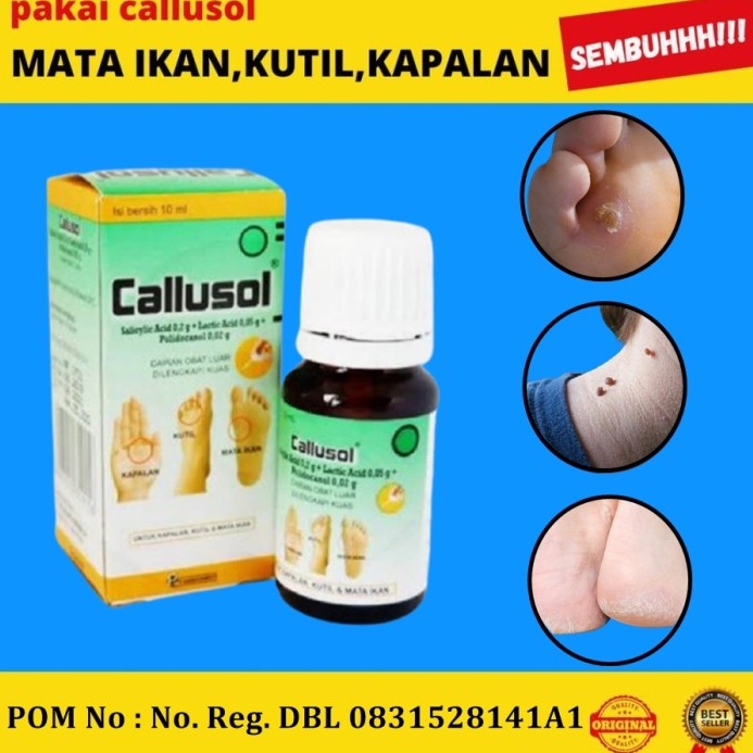 Jual CALLUSOL ORIGINAL OBAT MATA IKAN, KUTIL, KAPALAN | Shopee Indonesia