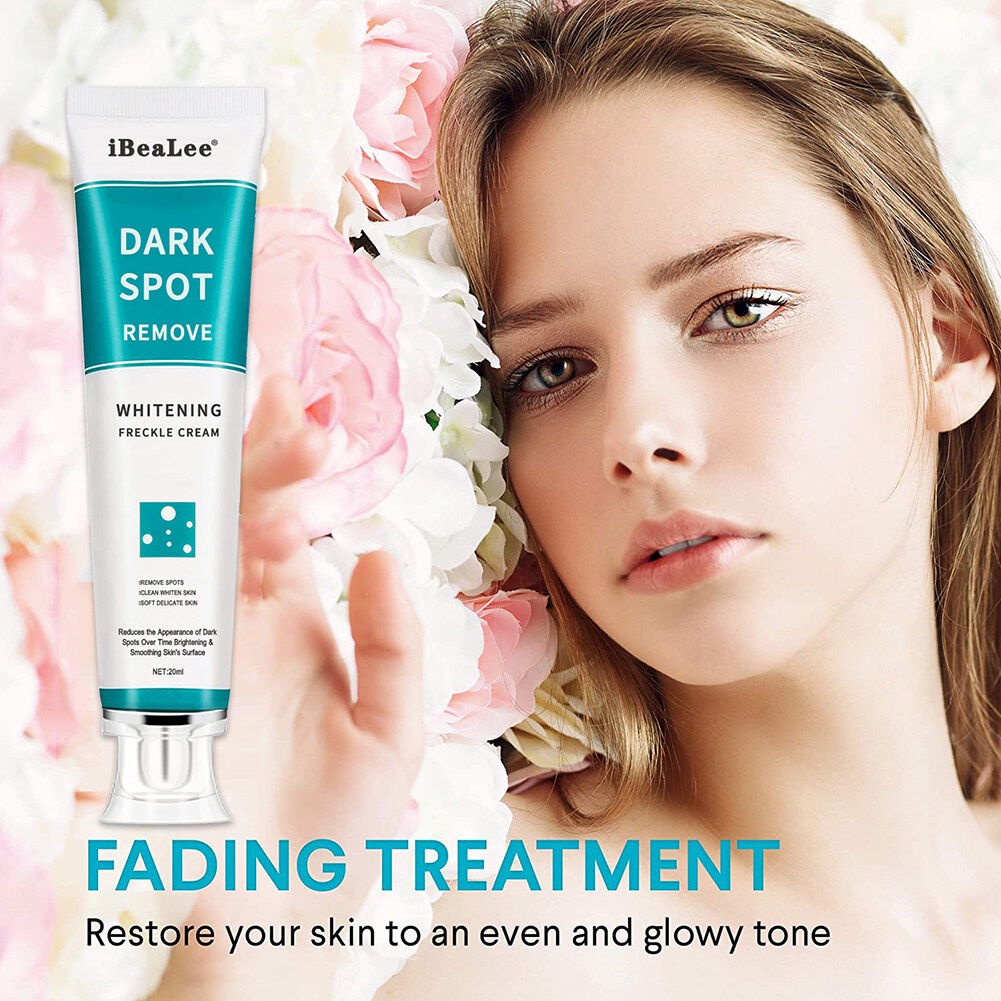 Jual Freckle Removal Cream Effectively Remove Acne Melasma Spots ...