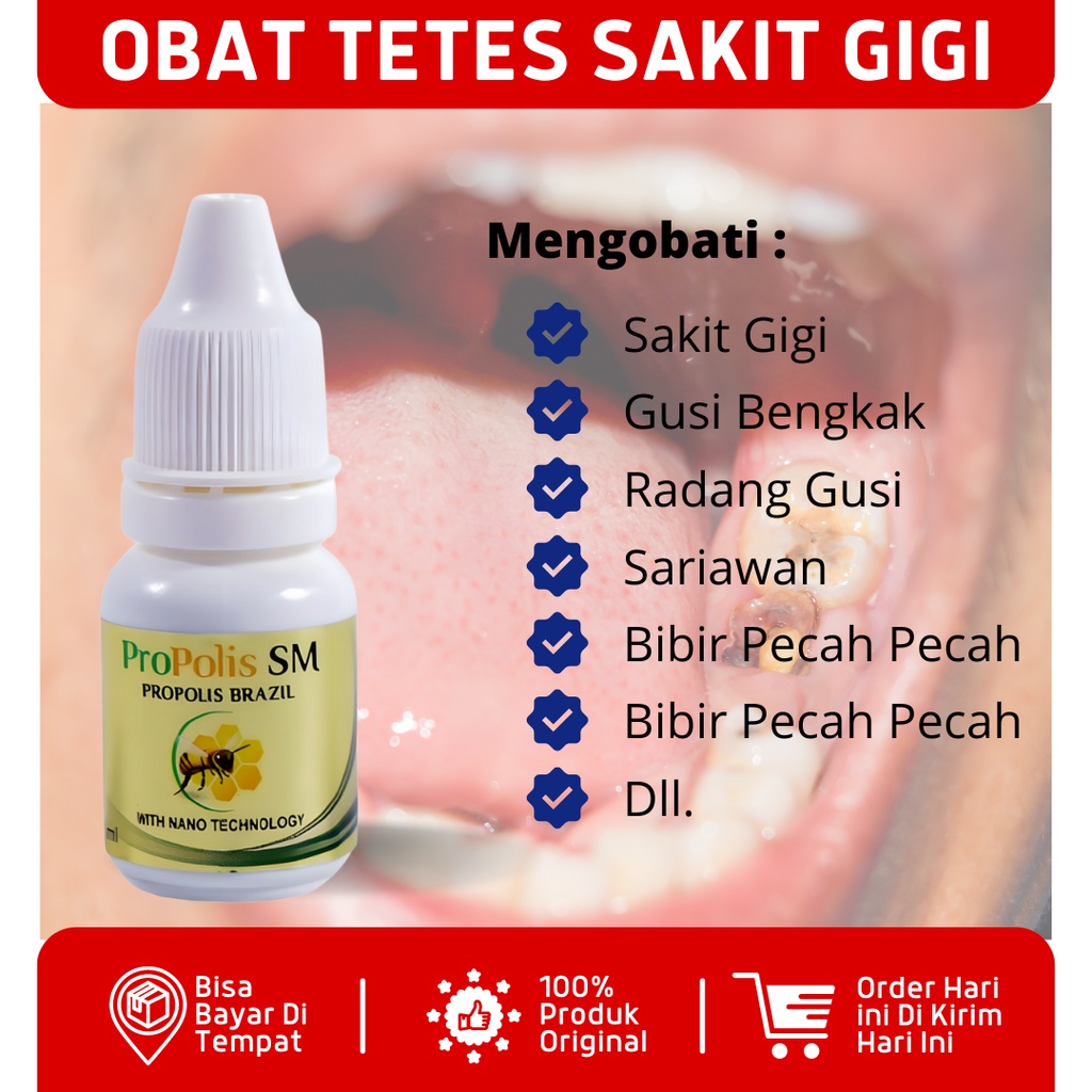 Jual ProPoli SM 6ml - Obat Tetes Sakit Gigi, Obat Sakit Gigi Anak ...