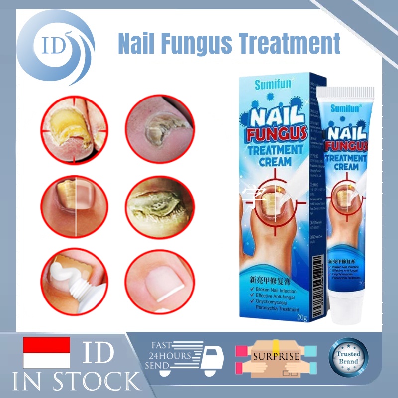 Jual obat kuku jamur dan rusak obat kuku rusak obat kuku cantengan obat ...