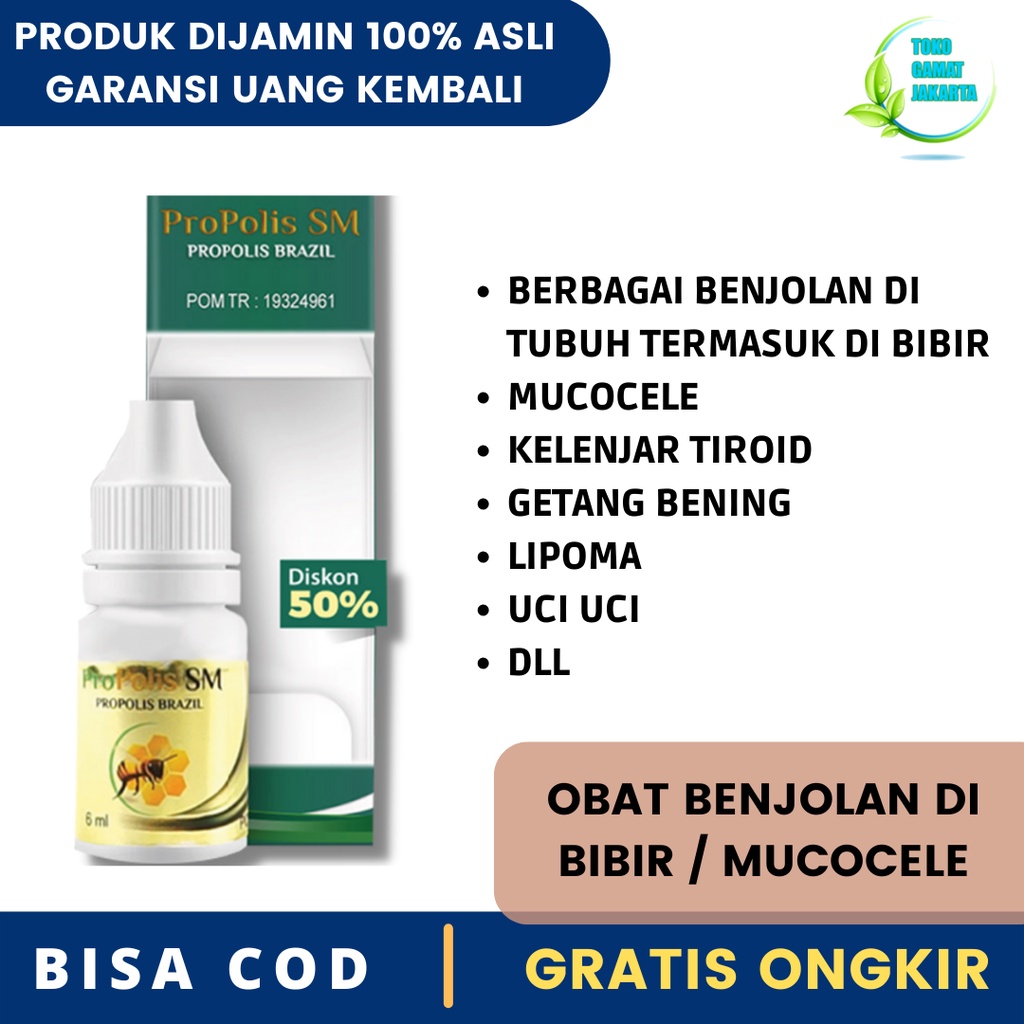 Jual Obat Benjolan Di Bibir Mulut Penghilang Mukokel Mucocele ...