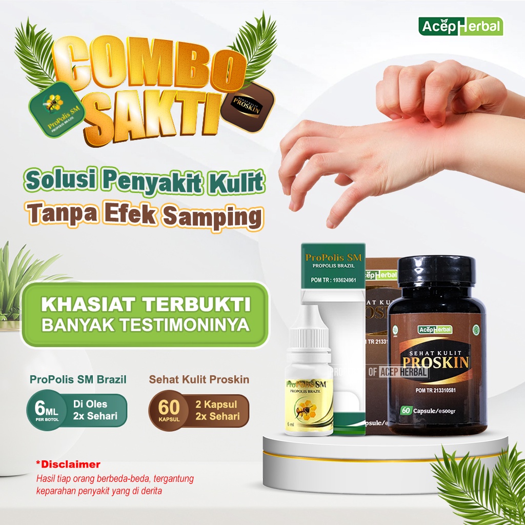 Jual Obat Kulit Gatal Budug Seluruh Badan Obat Jamur Kulit Eksim ...