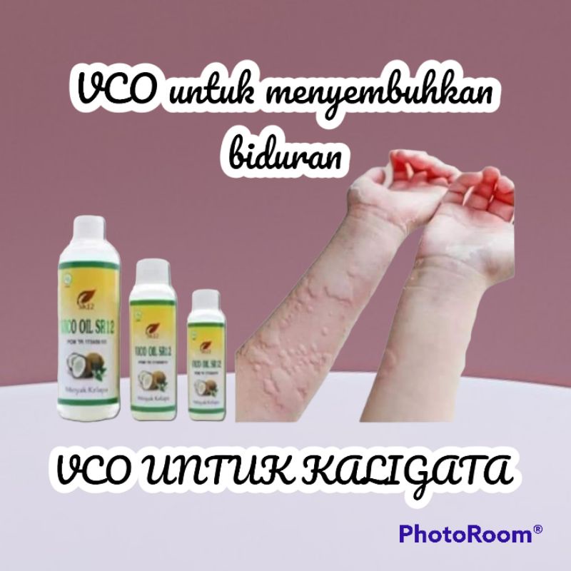 Jual VCO UNTUK BIDURAN GATAL-GATAL ATAU KALIGATA | Shopee Indonesia