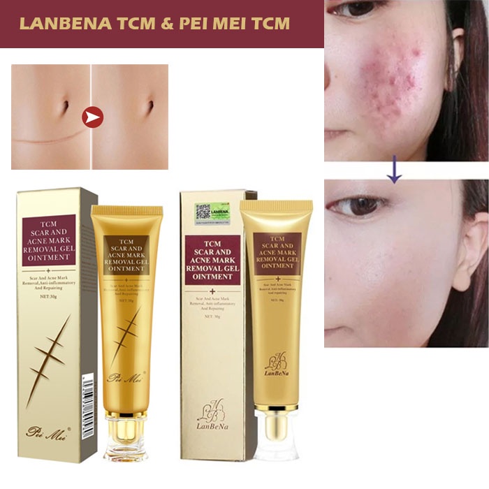 Jual TCM SCAR and ACNE REMOVAL gel ointment Penghilang Bekas Luka,Obat ...