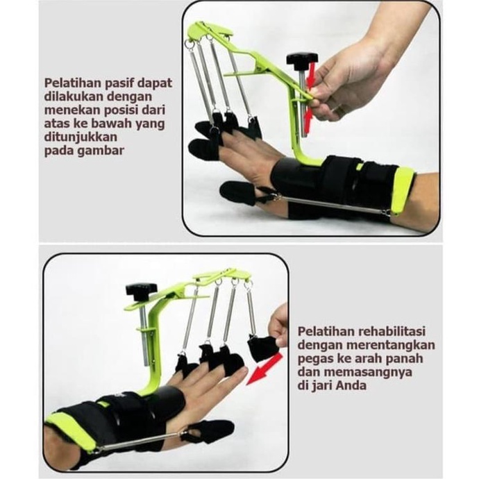Jual Alat terapi Stroke Dynamic Orthosis Stroke Fingers Hand ...