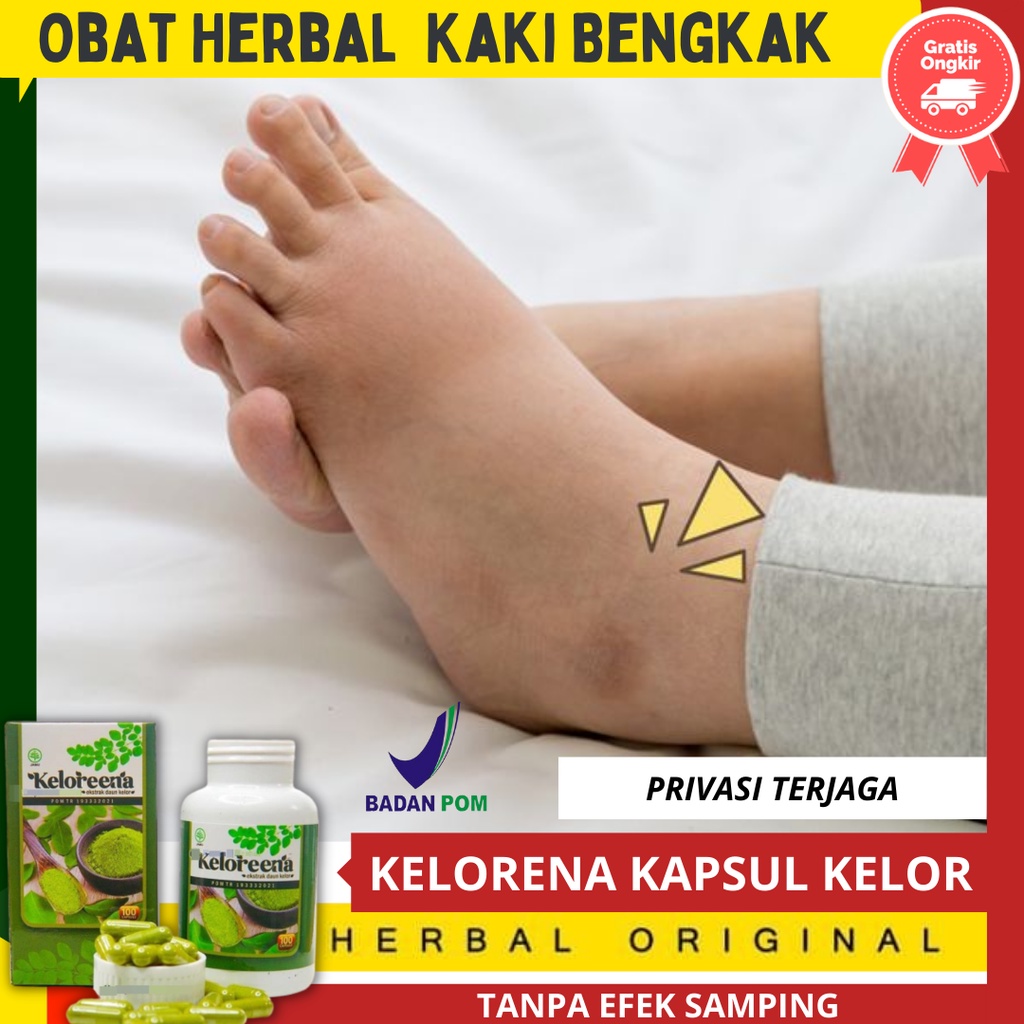Jual aturan minum obat kaki gajah, Obat Pengempes Kaki Bengkak, Pereda ...