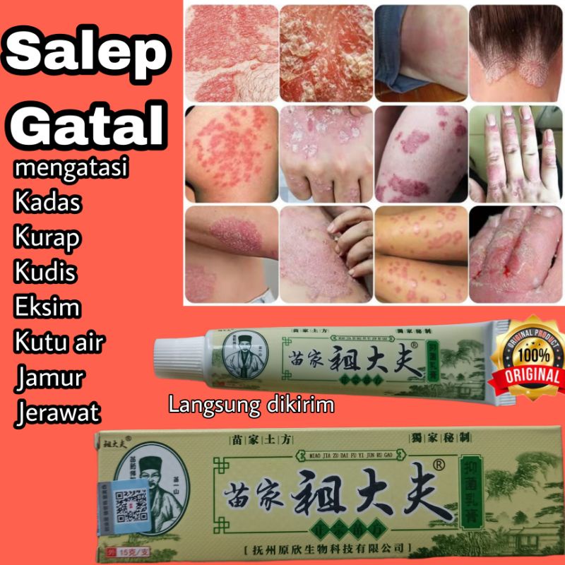 Jual Obat Gatal Salep Kulit Jamur Bakteri Kurap Selangkangan Zudaifu ...