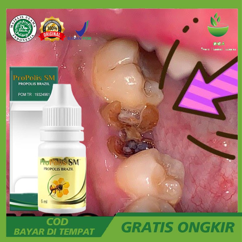 Jual Obat Sakit Gigi Berlubang Gusi Abses Gusi Bengkak Untuk Pria ...