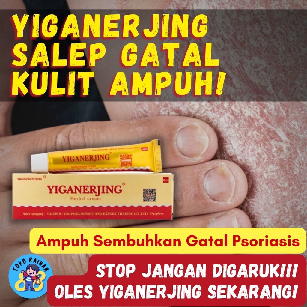 Jual Salep Gatal Yiganerjing Cream Obat Gatal Kulit Herbal Original ...