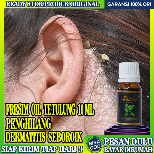 Jual Obat Dermatitis Seboroik,Obat Gatal Alergi Gatal Selangkangan,Fresim Oil 10ml,Obat Jari ...