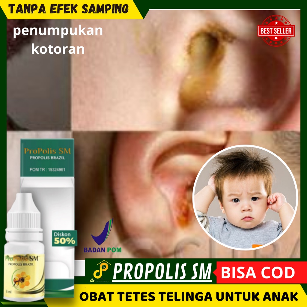 Jual Cara mengatasi telinga bau pada anak usia 16 bulan furunkel ...