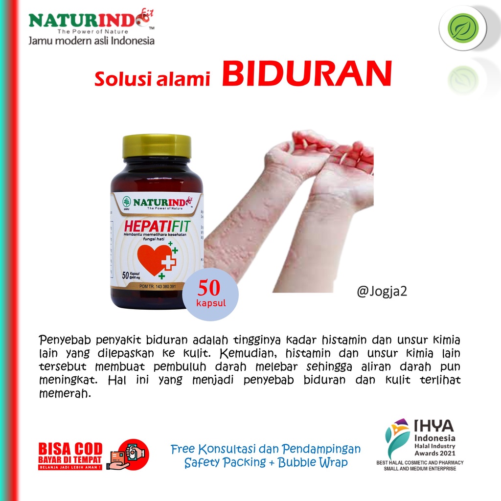 Jual Obat Biduran Alergi Gatal Alergi Dingin Gatal Biduran Kaligata ...