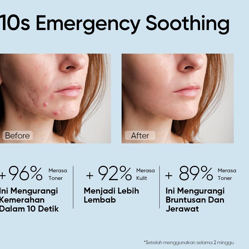 Jual [CODE WE26] SKINTIFIC - Soothing Repair Skin Barrier Paket Skincare with 5X Ceramide ...