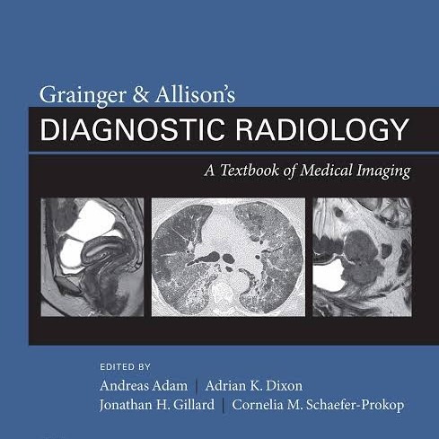 Jual Gudang Grainger & Allison's Diagnostic Radiology: 2-Volume Set, 6e ...