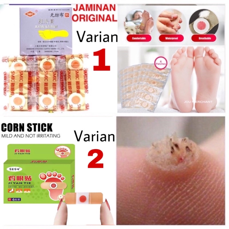 Jual Plester Kutil Mata Ikan Kaki Kapalan Ji Yan Gao Obat Kutil Kapalan ...