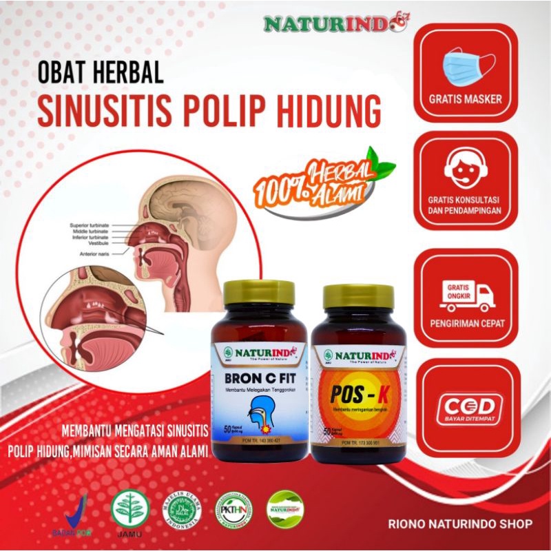 Jual Obat Polip Hidung Sinus Sinusitis Rinitis Polip Flu Menahun Pilek ...