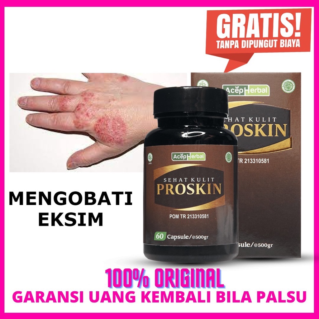 Jual Obat Penyakit Eksim Dermatitis Proskin sehat kulit herbal alami ...