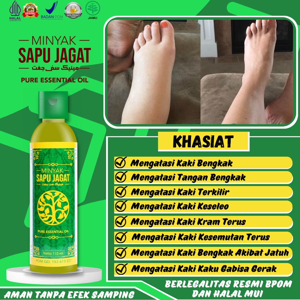 Jual Obat Kaki Dan Tangan Bengkak Akibat Cidera, Tangan Bengkak, Kaki ...