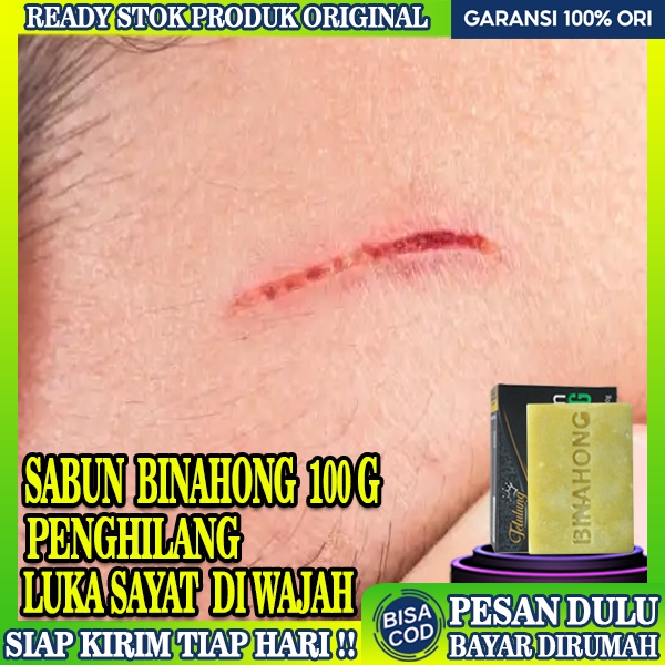 Jual Obat Luka sayat,Obat Herbal Untuk Luka,Sabun Binahong 100g,Obat ...