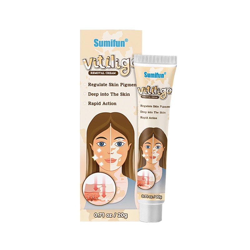 Jual Salep obat luar utk vitiligo, Salep khusus bercak putih yg cepat ...