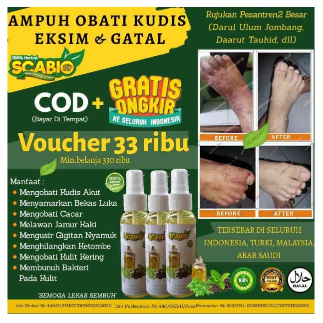 Jual Obat Herbal Scabio Ampuh Mengatasi Scabies pada Anak, Kudis ...