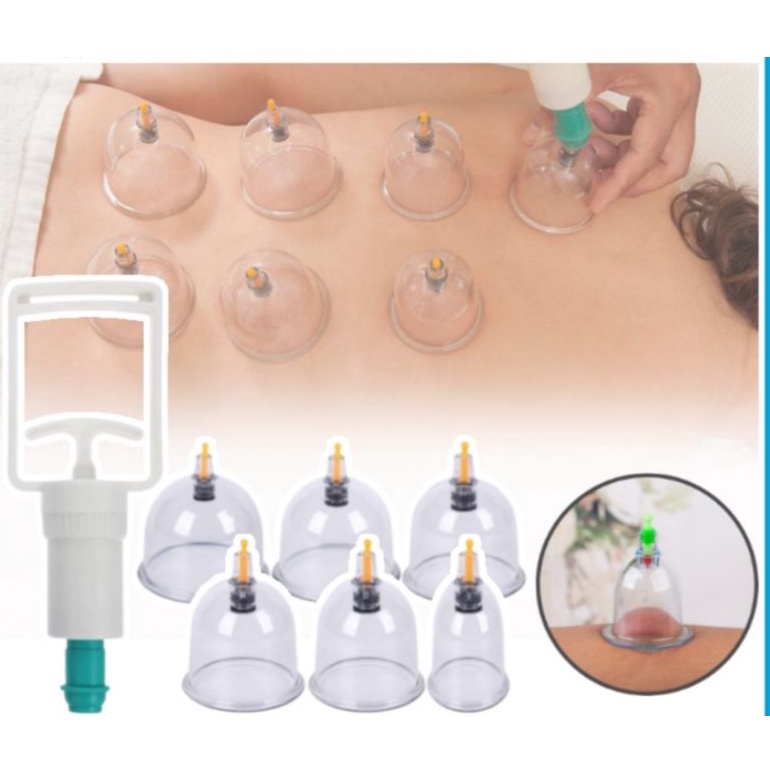 Jual ALAT BEKAM KOP ANGIN ISI 6 / ALAT KOP KESEHATAN / ALAT MASUK ANGIN ORIGINAL | Shopee Indonesia