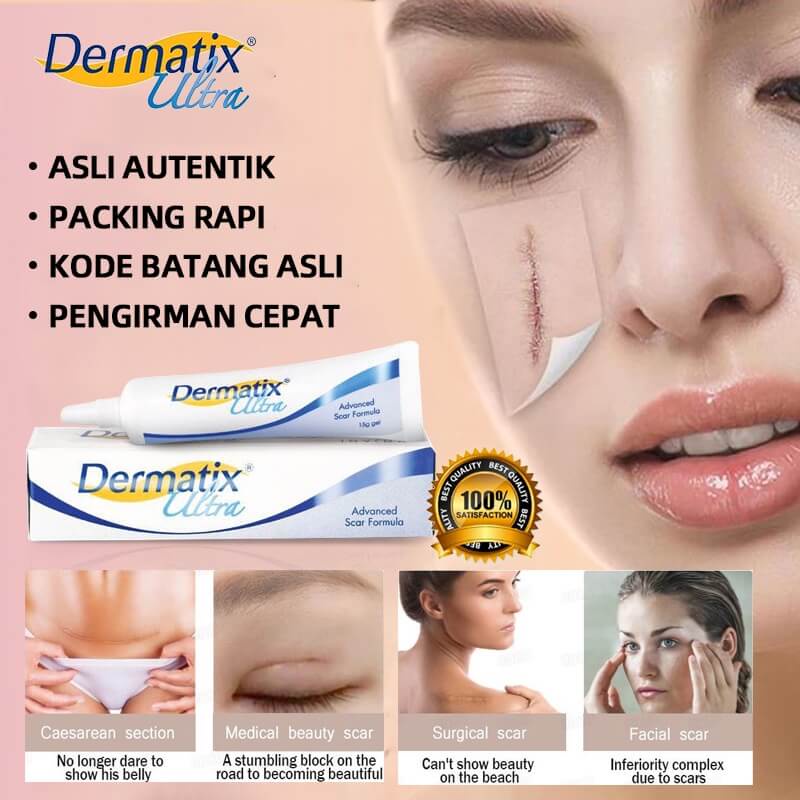 Jual Dermatix Ultra Penghilang Bekas Luka Keloid ANTI SCAR Stretchmark Advanced Scar Dermatix ...
