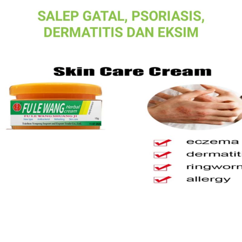 Jual SALEP GATAL FLE-WANG ATASI EKSIM DERMATITIS ALERGI | Shopee Indonesia