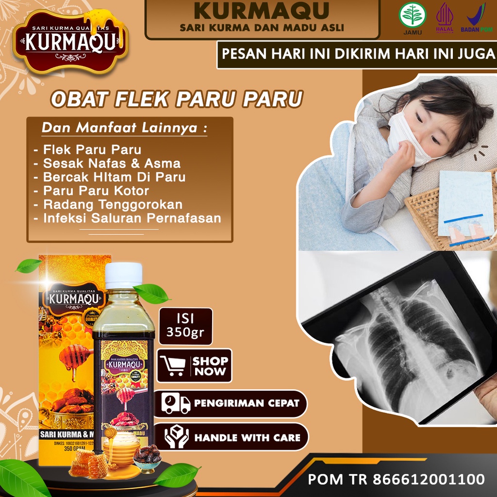 Jual Obat Flek Paru Paru Anak Infeksi Radang Paru Bercak Hitam Di Paru ...