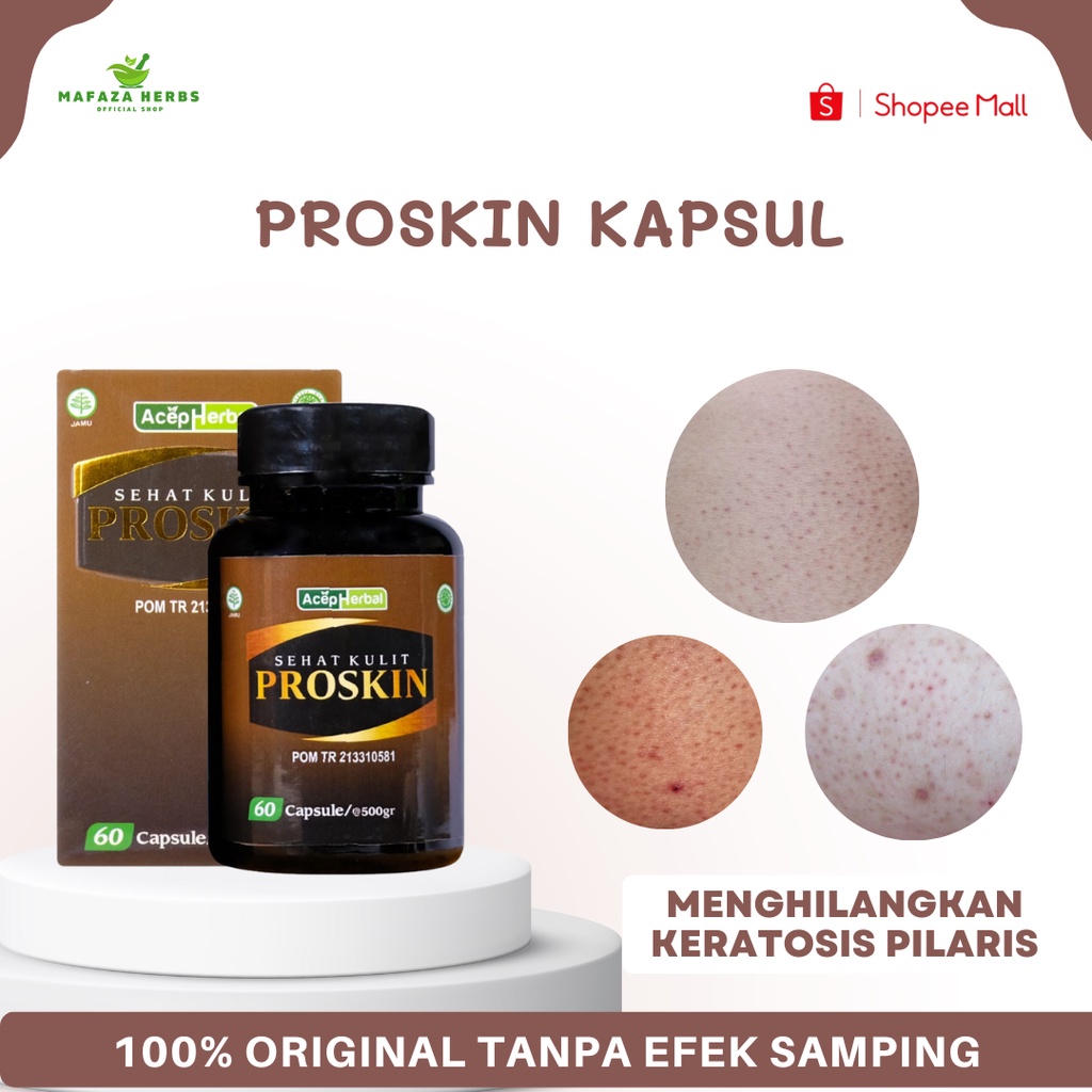 Jual Proskin - Obat Keratosis Pilaris, Bintik Hitam Di Kulit, Bintik ...