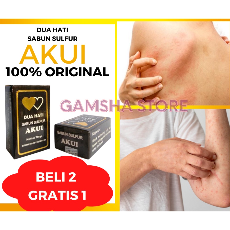 Jual Akui SABUN Belerang Sulfur Anti Bakteri Obat Kulit Gatal Penyakit ...