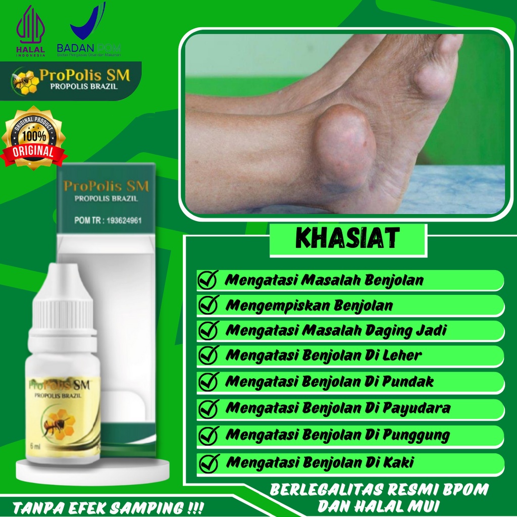 Jual Obat Benjolan Di Leher, Obat Benjolan Payudara, Benjolan Di Paha ... Jual Obat Benjolan Di Leher, Obat Benjolan Payudara, Benjolan Di Paha ...