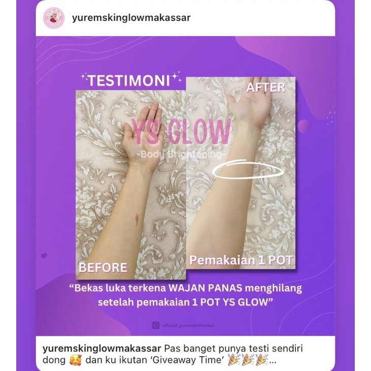 Jual Yurem Skin Lotion (Body Lotion Yurem) HB Yurem | Shopee Indonesia