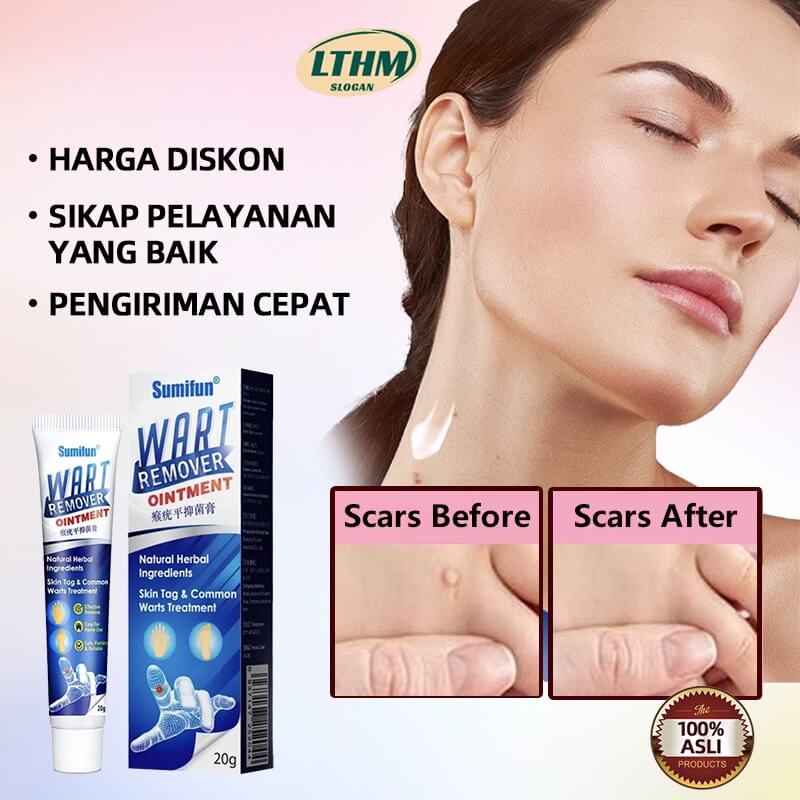Jual SUMIFUN Wart Remover Ointment penghilang tahi lalat obat ...