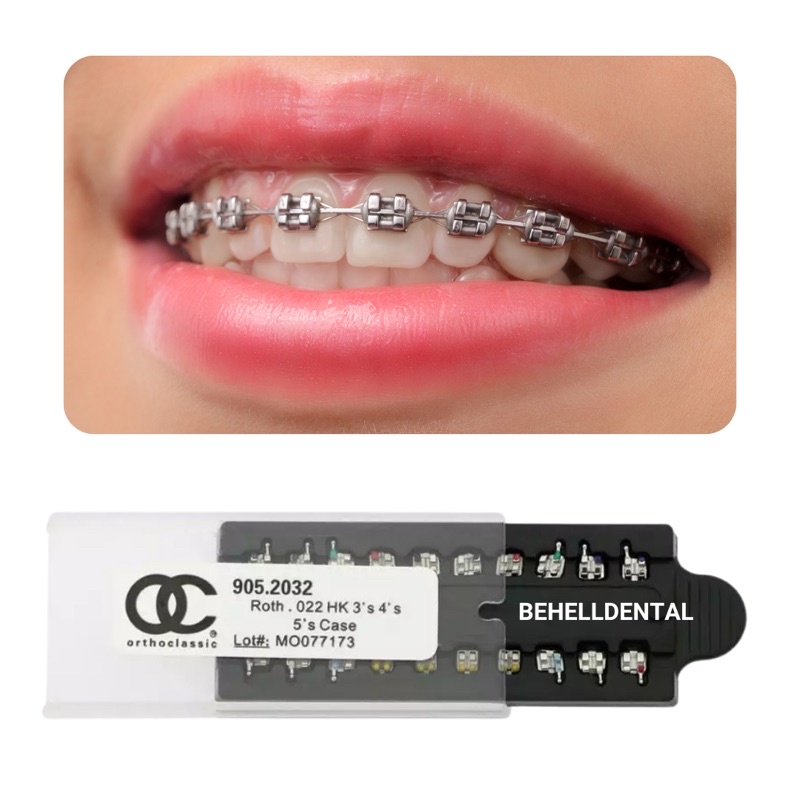 Jual ORI | BRACKET BEHEL METAL ORTHO CLASSIC USA | ROTH KAWAT PERMANEN ...